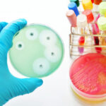 CAD Full Form: CAD Stands for Coronary Artery Disease