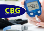 CBG Full Form in Medical: CBG Stands for Capillary Blood Glucose