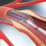 MCH Full Form in Medical