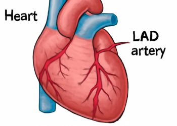 LAD Full Form in Medical: Left Anterior Descending Artery
